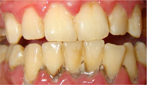 Periodontology - DentHealth